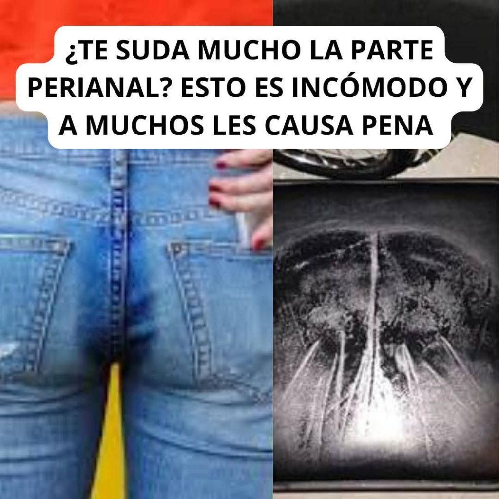 ¿Te suda la parte perianal? Tranquilo, es más común de lo que crees. – Corte de Pelo